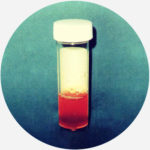 serosanguinous | Meaning & Origin | Dictionary.com